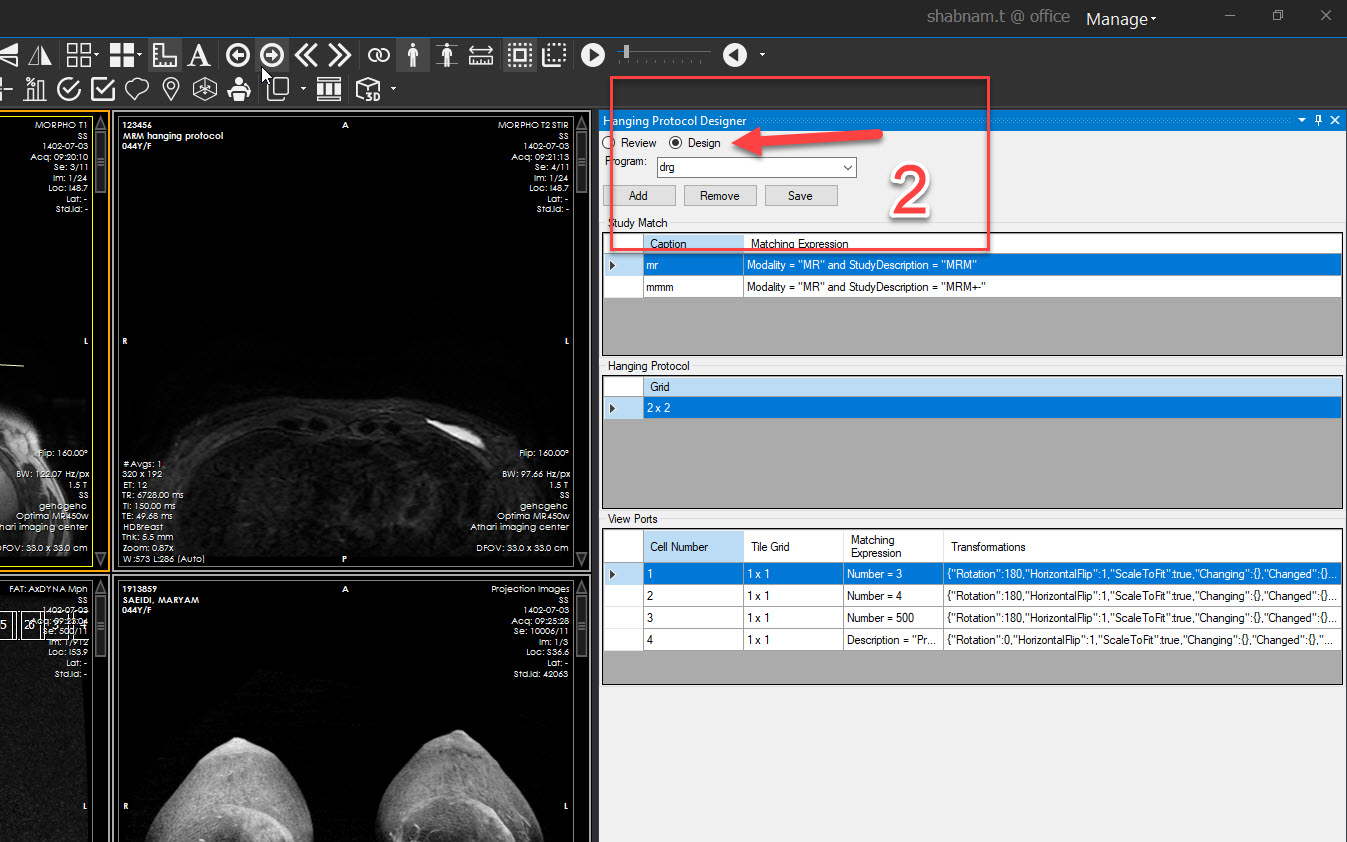 Hanging Protocols in Radiology - blog-nestopiaa