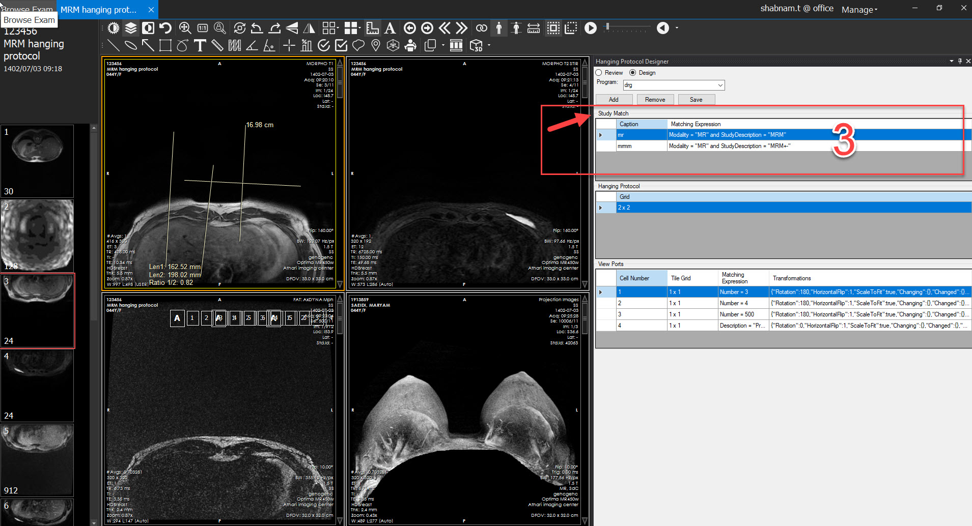 Hanging Protocols in Radiology - blog-nestopiaa