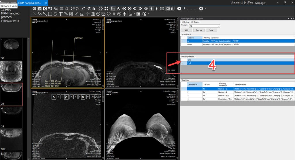 Hanging Protocols in Radiology - blog-nestopiaa