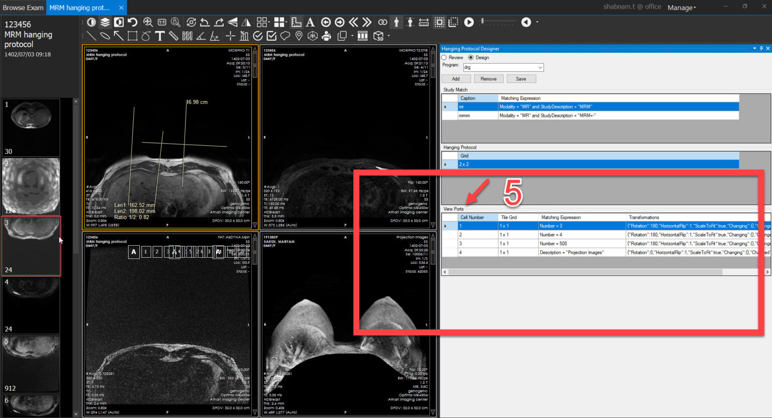Hanging Protocols in Radiology - blog-nestopiaa