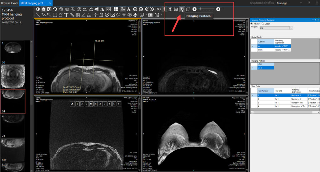 Hanging Protocols in Radiology - blog-nestopiaa